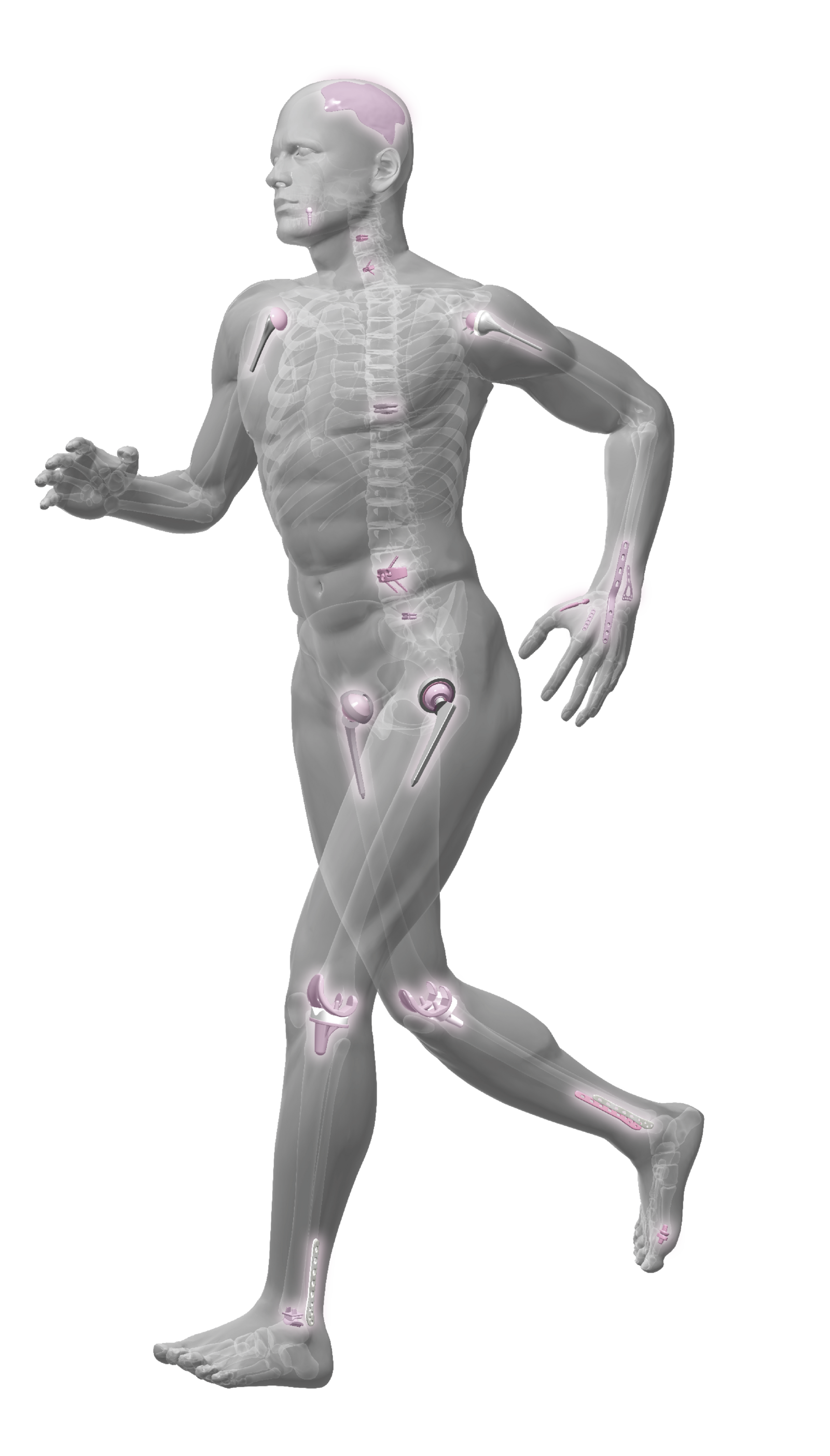 BIOLOX®delta a benchmark in modern ceramic joint replacement