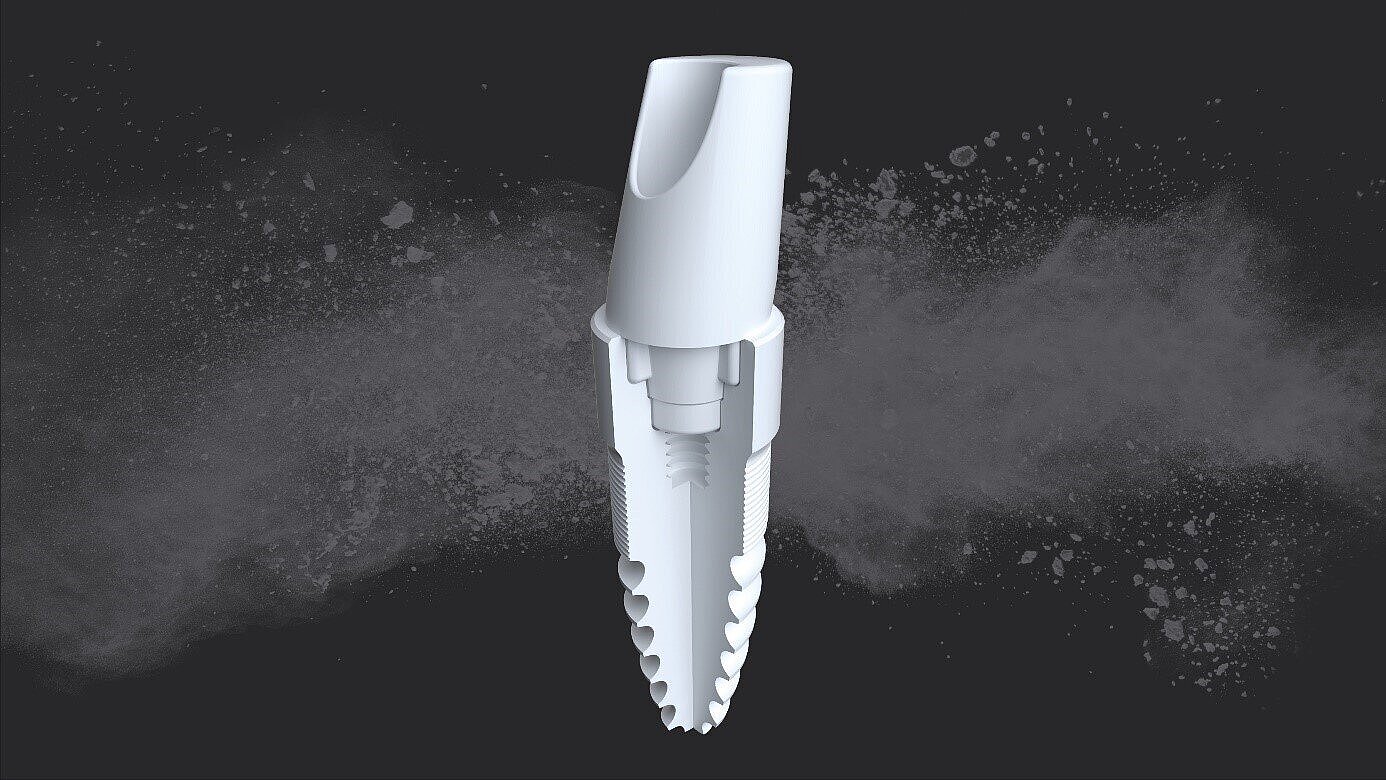 Results of the ESCI survey on "Clinical Approach to Ceramic Dental ...