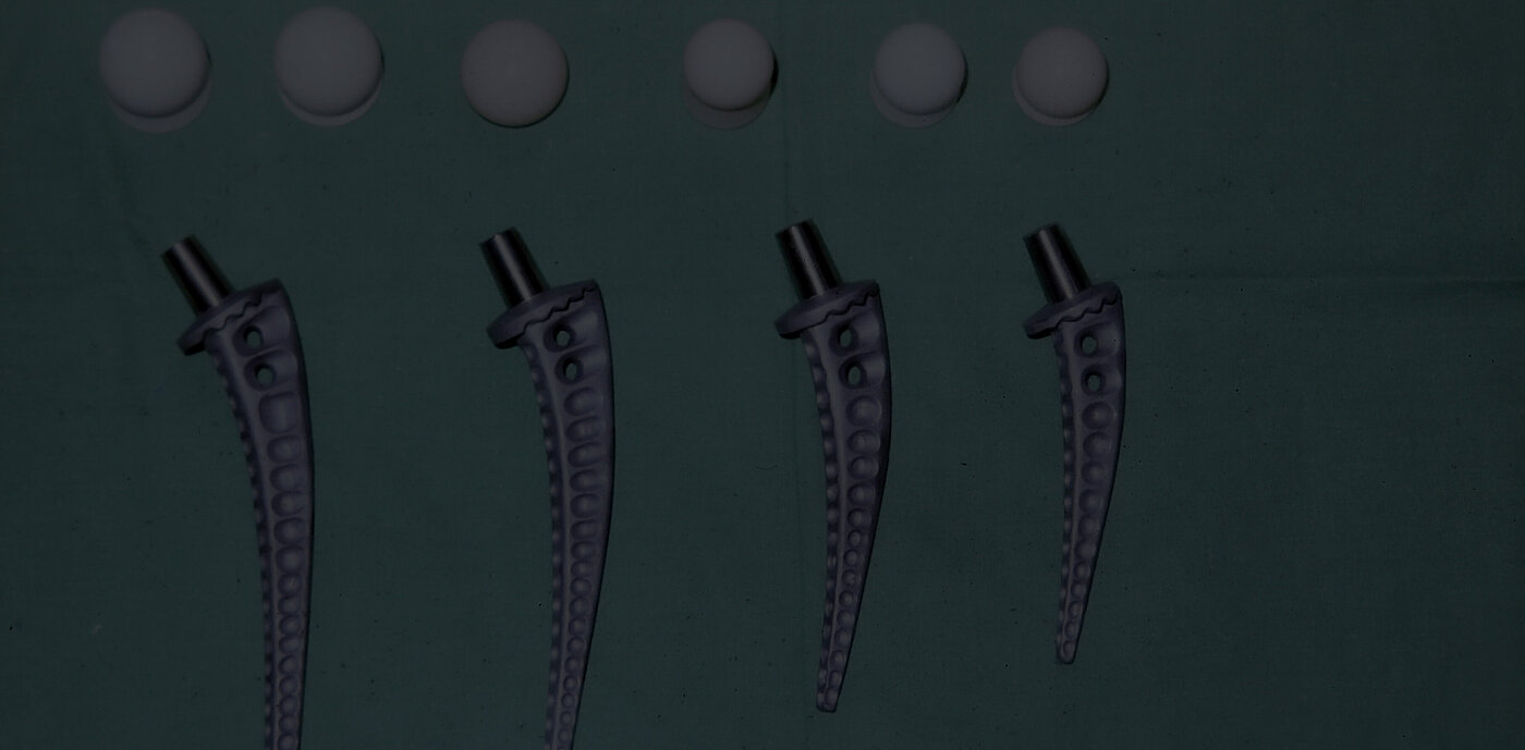 Revolutionizing Joint Replacement: The pioneering taper fixation by Dr ...