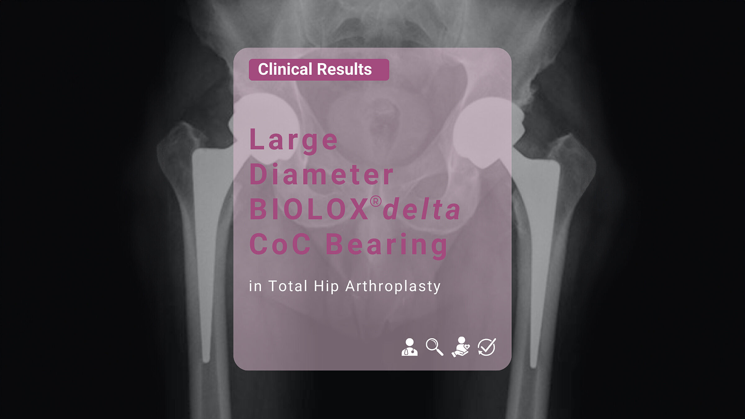 98.7% Survivorship and High Patient Satisfaction with LDH Monobloc ...