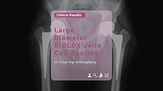 BIOLOX®delta a benchmark in modern ceramic joint replacement