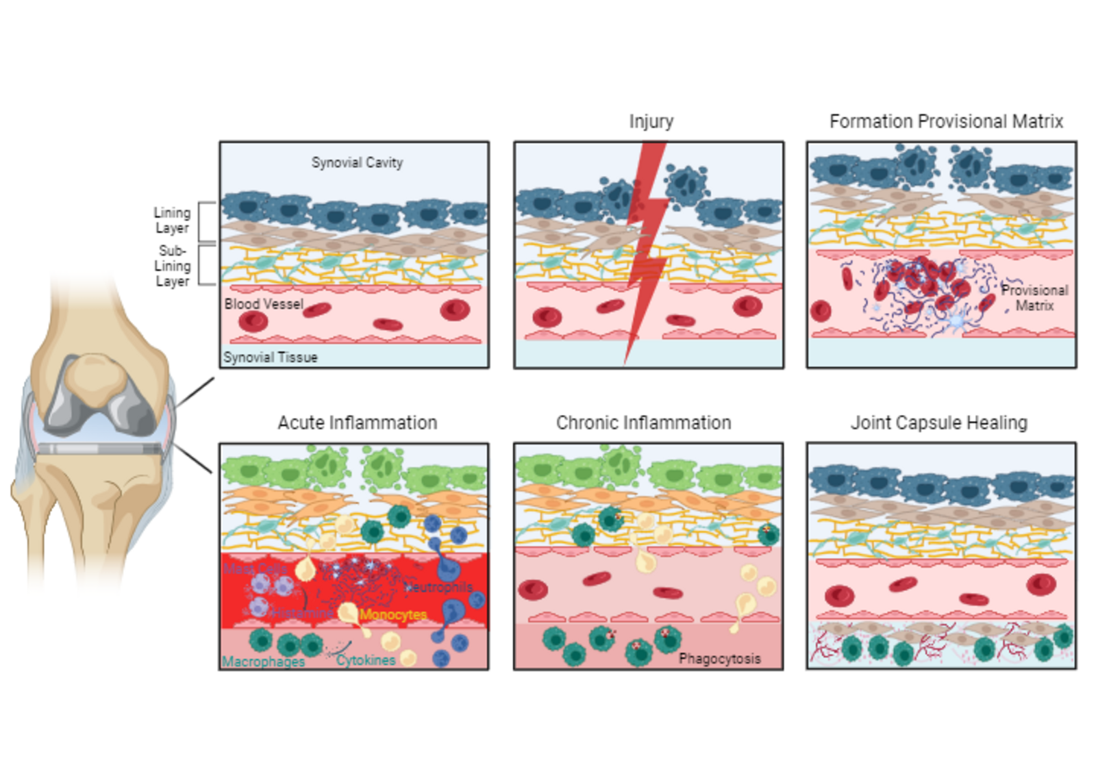 Under the microscope: understanding the immune dynamics of joint ...