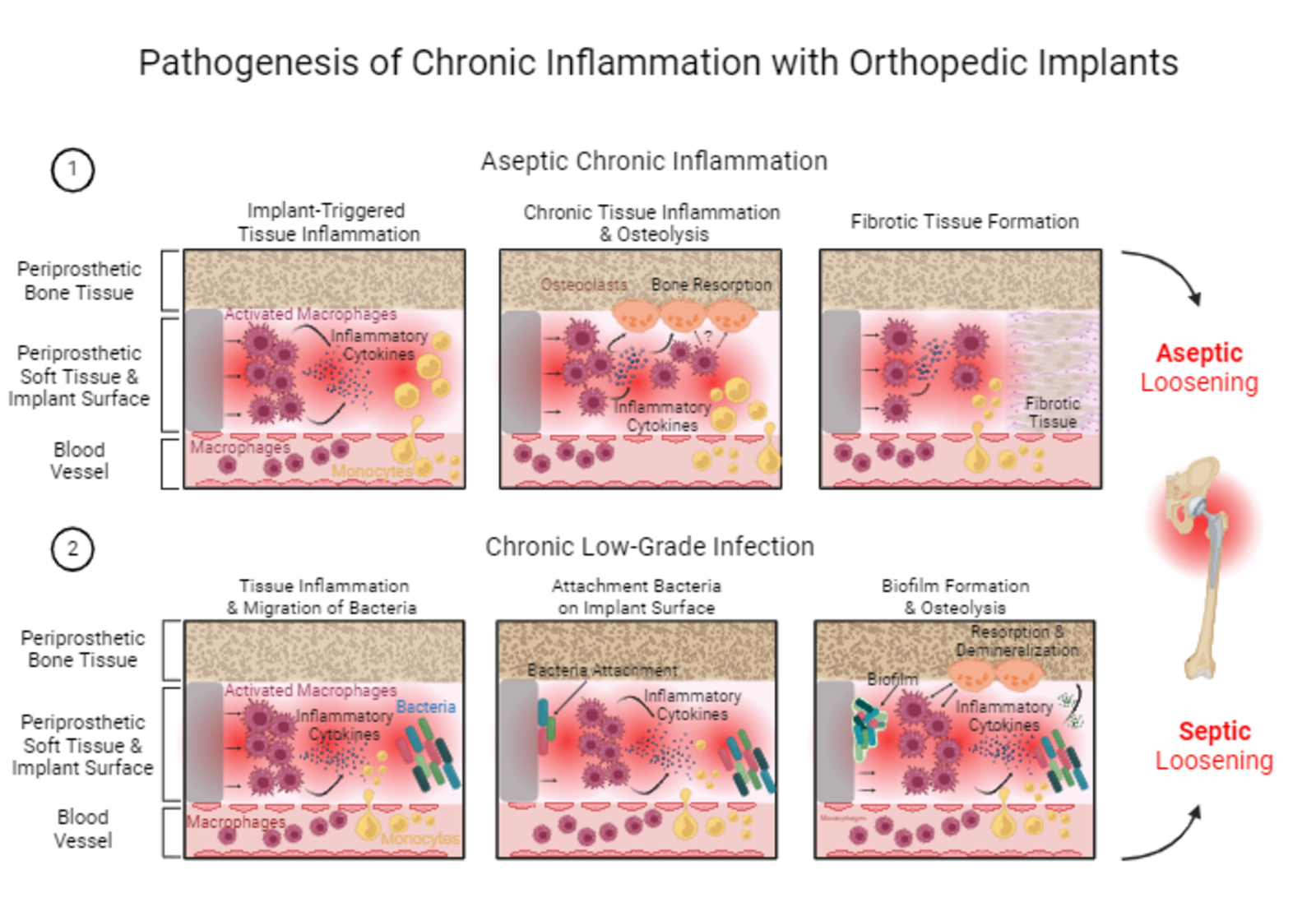 Chronical Inflammation