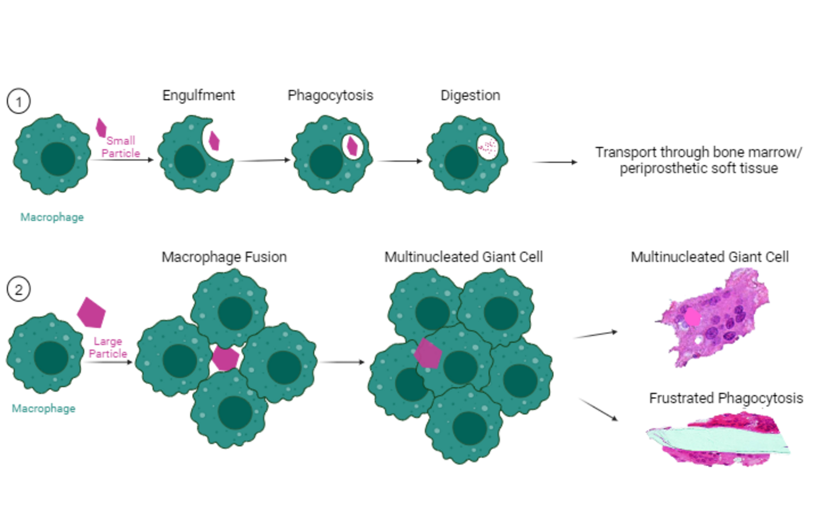 Under the microscope: understanding the immune dynamics of joint ...