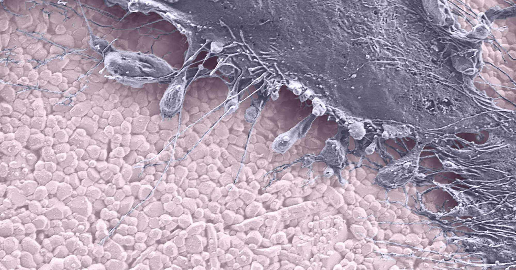 Ceramic material for implantation, BIOLOX®delta and BIOLOX®forte in hip ...