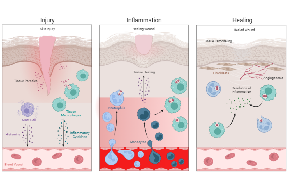 Under the microscope: understanding the immune dynamics of joint ...
