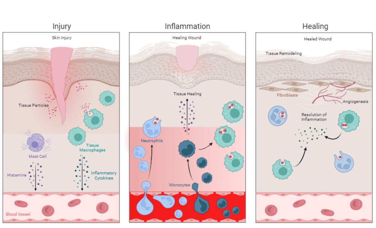 Under the microscope: understanding the immune dynamics of joint ...