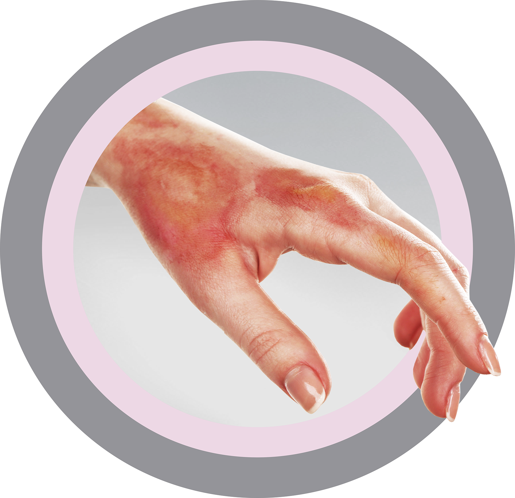 BIOLOX® Bio Ceramic CeramTec-Medical